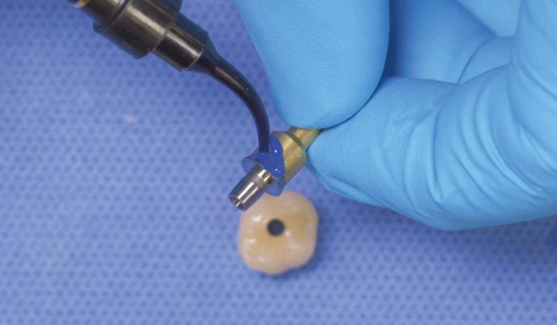 Titanium base implant cementation technique