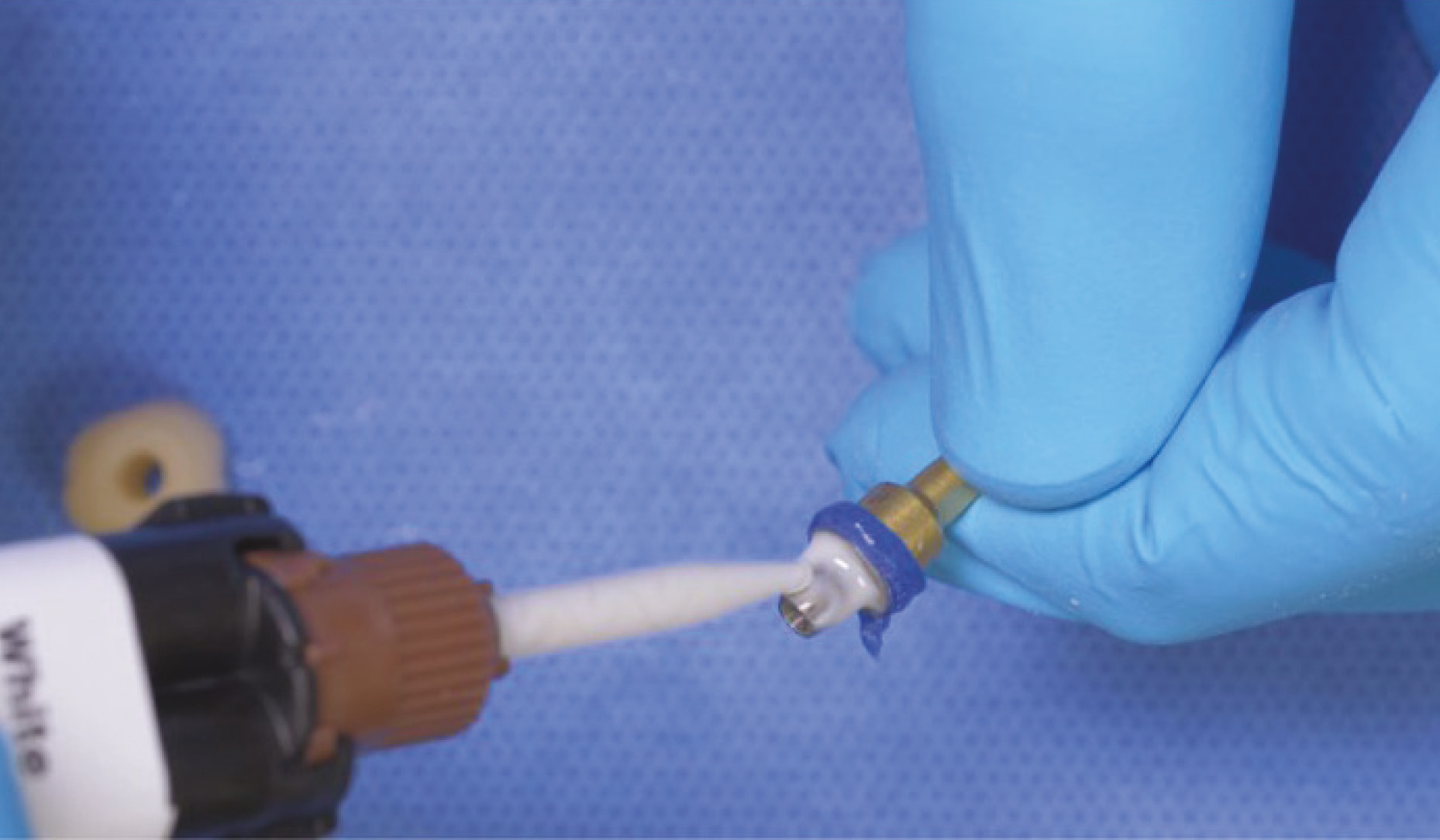 Titanium base implant cementation technique